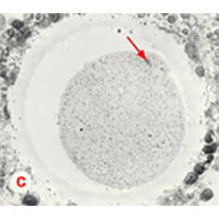 Virtual Human Embryo - DREM Database: Carnegie Stage 1