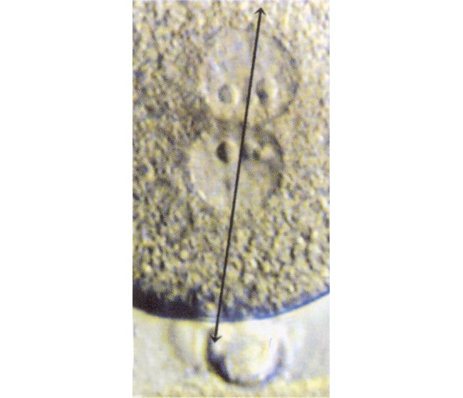 Virtual Human Embryo - DREM Database: Carnegie Stage 1